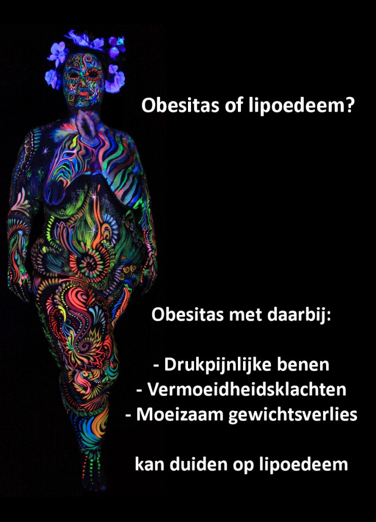 Lipoedeem - Fysiotherapie de Mare